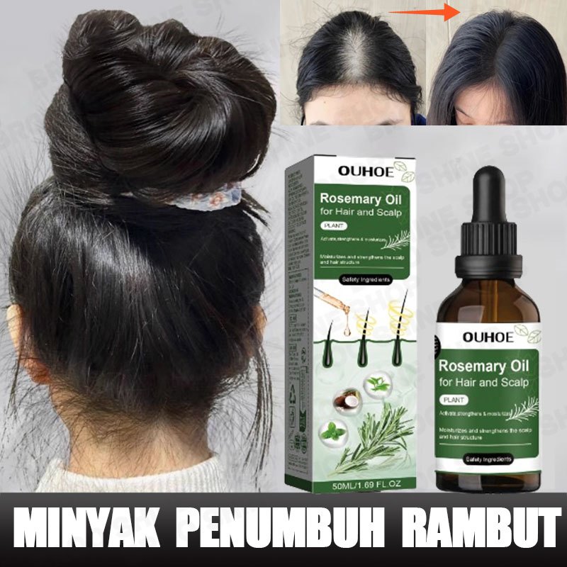 Jual Penumbuh Rambut Cepat Dan Tebal Rambut Rontok Hair Growth Oil ...