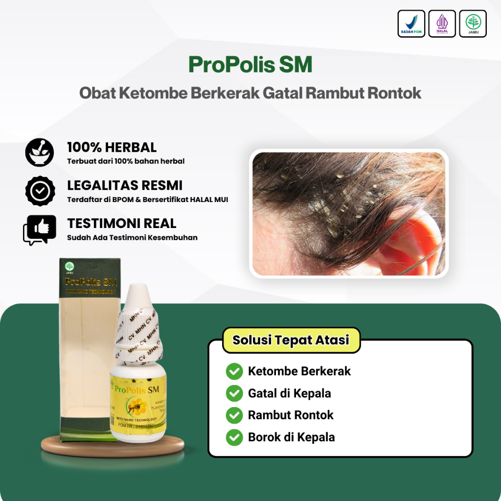 Jual Propolis SM - Obat Ketombe Gatal Kulit Kepala Berkerak Rambut Rontok | Shopee Indonesia