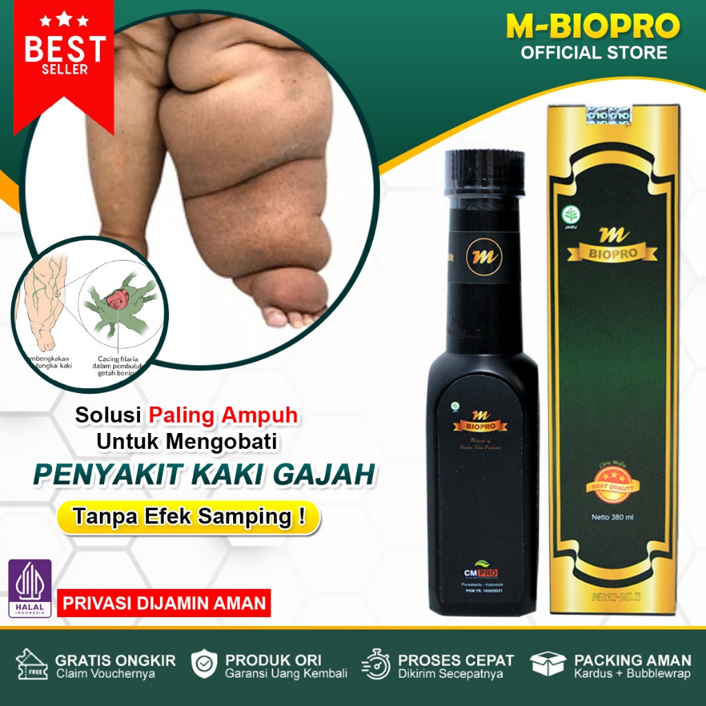Jual Obat Kaki Gajah Herbal Paling Ampuh - Penyakit Filariasis Limfatik ...