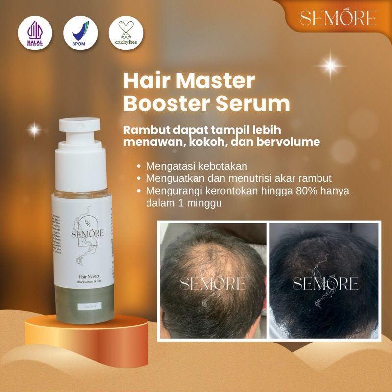 Jual SEMORE Hair Tonic Master Booster Serum Treatment Penumbuh Rambut ...