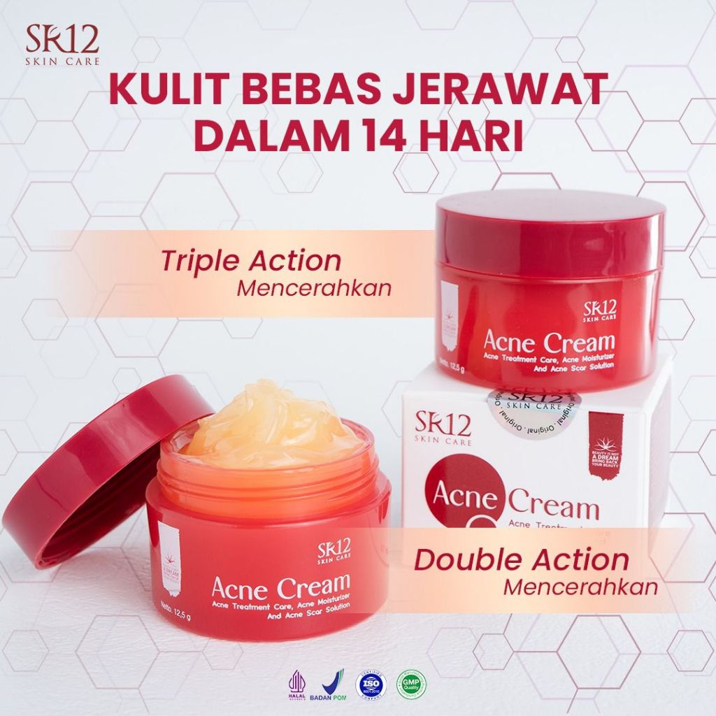 Jual SR12 Acne Cream Skincare - Krim Treatment Jerawat - Mengatasi ...