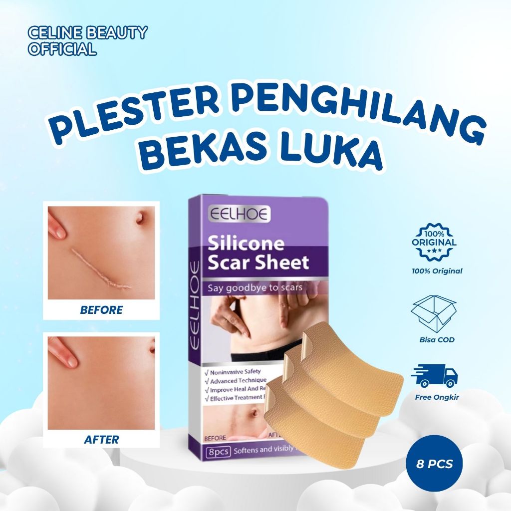 Jual 8pcs Silicone Scar Sheets Eelhoe - Plaster penghilang bekas luka ...