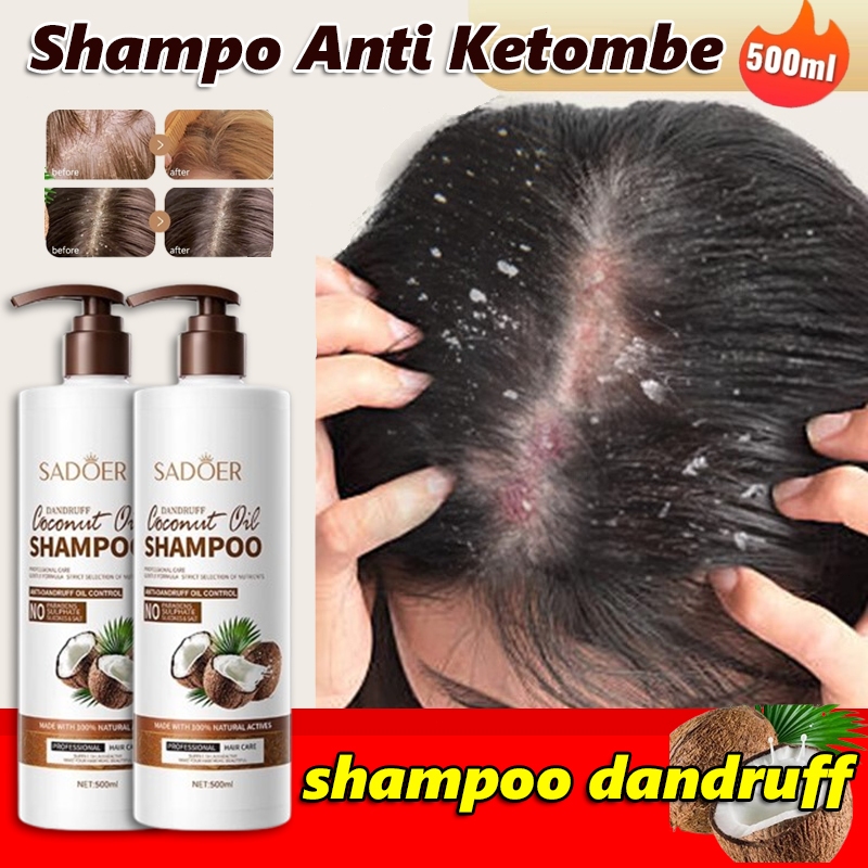 Jual Shampo Anti Ketombe Dan Anti Ketombe Dan Rontok Shampoo Gatal Menghilangkan Ketomed Shampoo ...