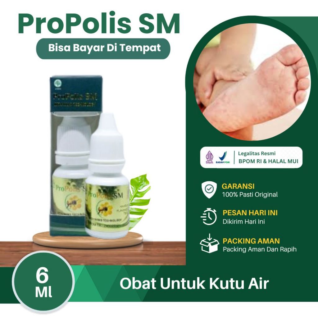 Jual Obat Untuk Kutu Air Di Kulit, Ruam Kutu Air, Kutu Air Gatal, Jamur ...