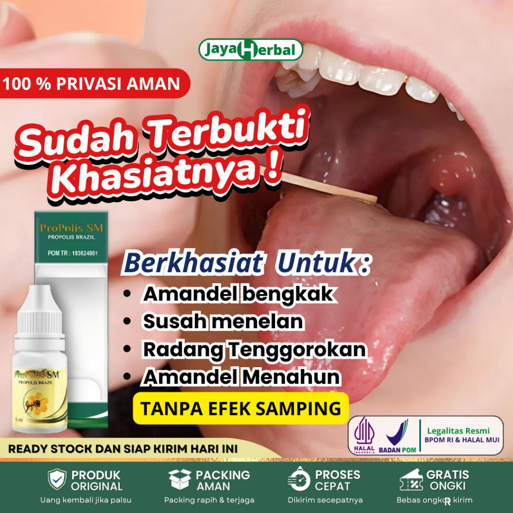 Jual Obat Tetes Amandel, Amandel Akut, Pengempes Amandel, Amandel ...