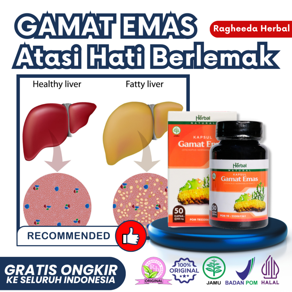 Jual Obat Perlemakan Hati (Fatty Liver) - Hepatic Steatosis Penumpukan ...