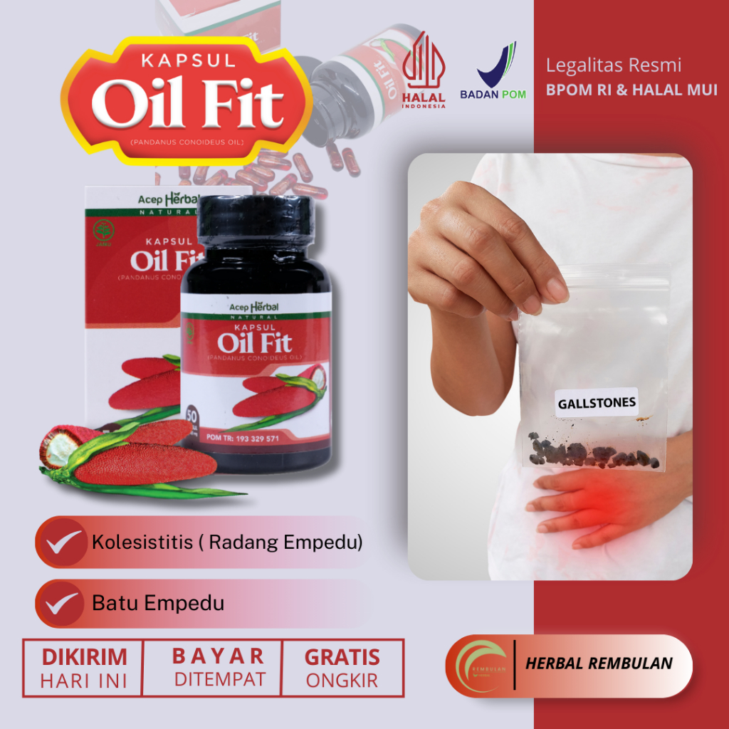 Jual Kapsul Oil Fit Obat Batu Empedu, Obat Radang Empedu, Obat ...