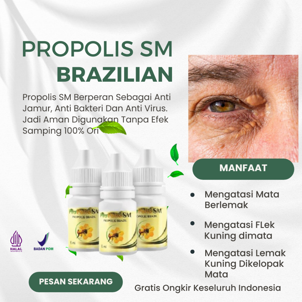 Jual Obat Xanthelasma, Obat Gumpalan Lemak Di Kelopak Mata, Obat ...