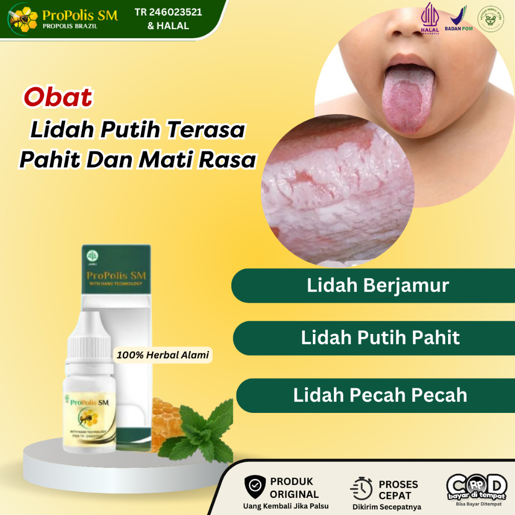 Jual Obat Lidah Berjamur, Obat Lidah Putih, Obat Lidah Pahit, Obat Bau ...