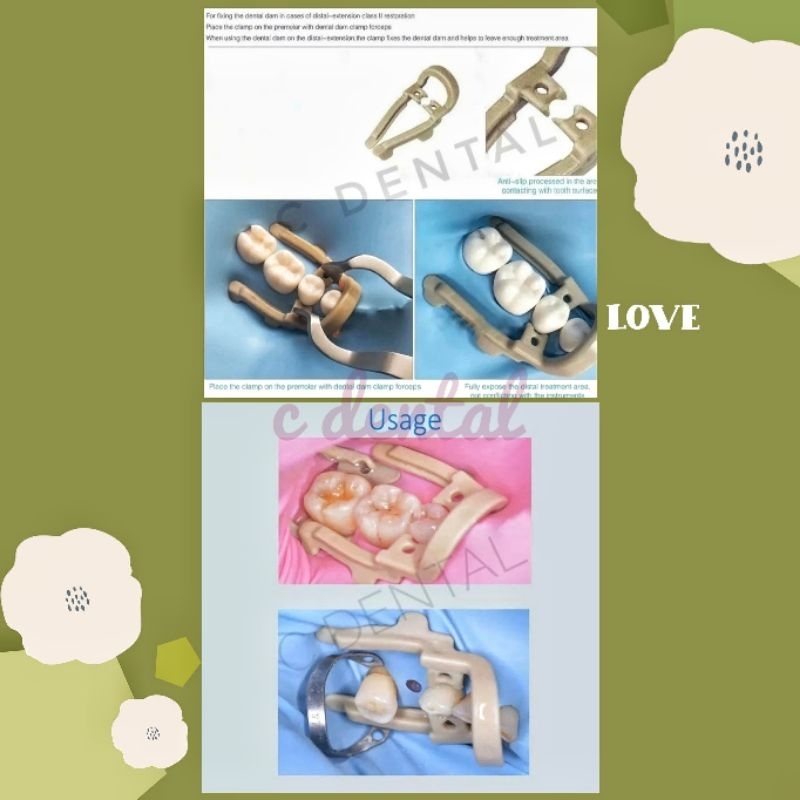 Jual Dental Endo Rubber Dam Soft Clamp Perluasan Distal Extender ...