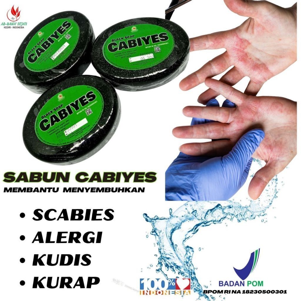 Jual CABIYES Sabun Gatal Scabies Panu Kurap Kudis Eksim Dermatitis ...