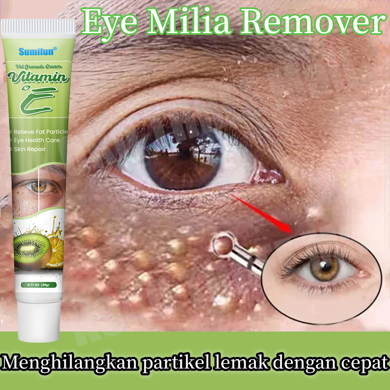 Jual krim penghilang milia obat milia di bawah mata salep milia di ...