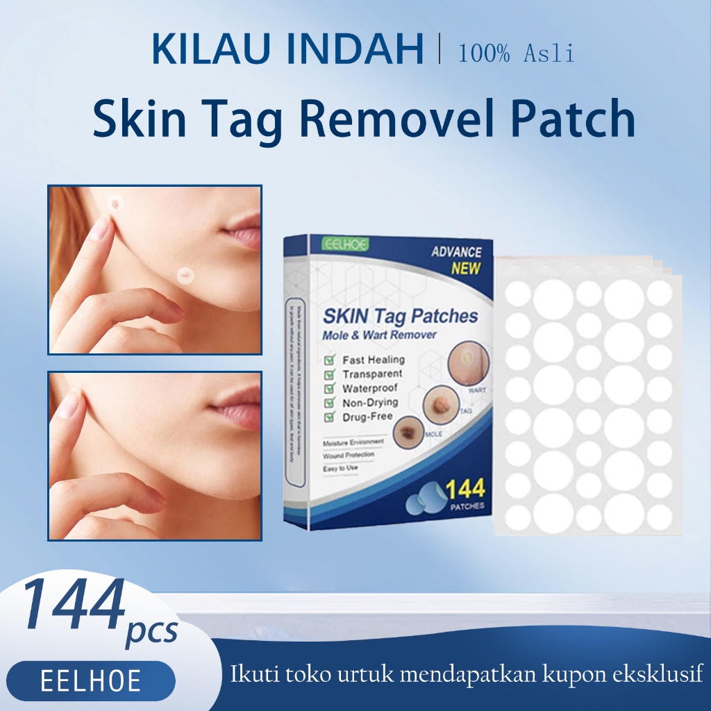 Jual EELHOE Stiker Penghilang Kutil dan Tahi Lalat 144pcs Wart Removal ...