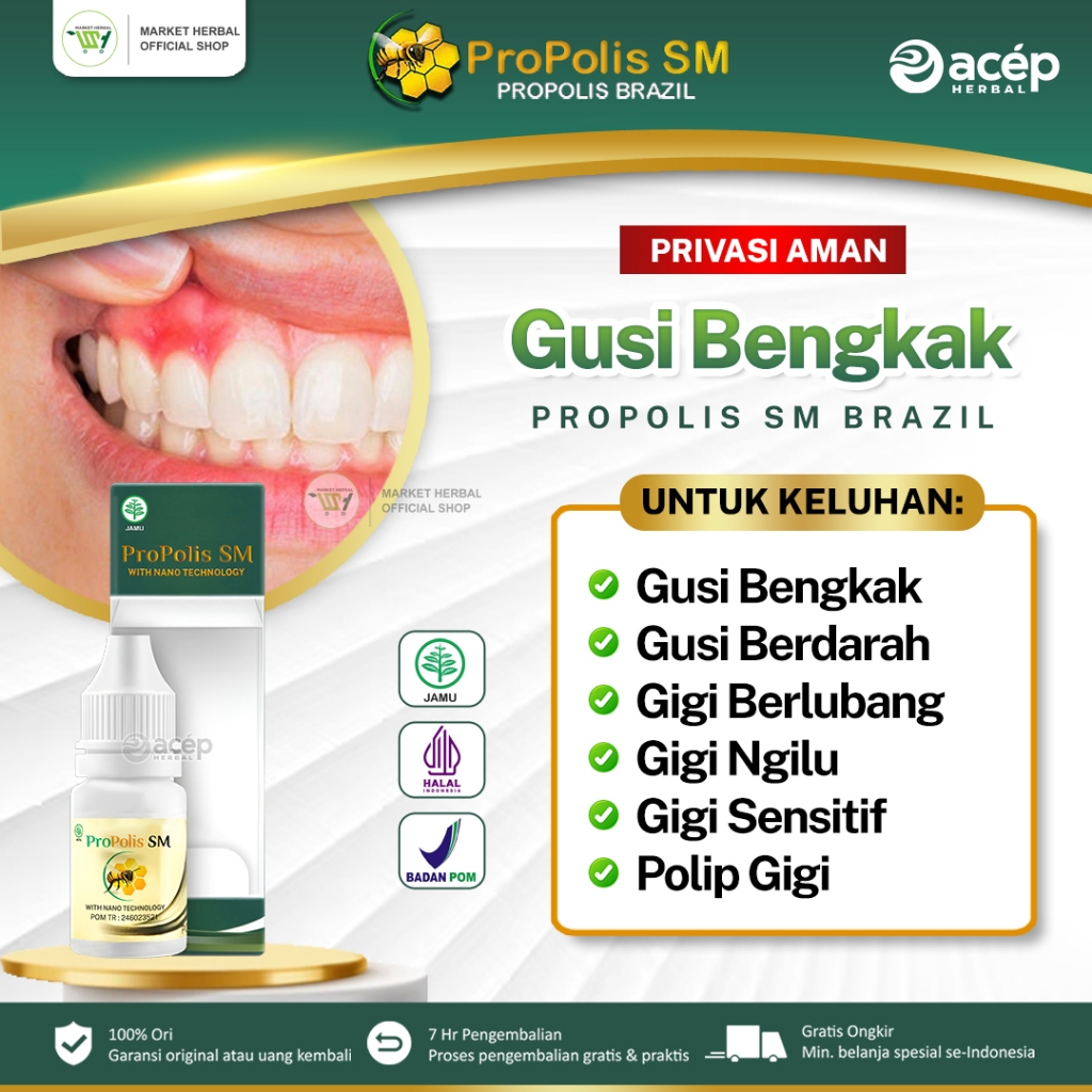 Jual Obat Gusi Bengkak Gusi Berdarah Gigi Berlubang Abses Gigi Gusi ...