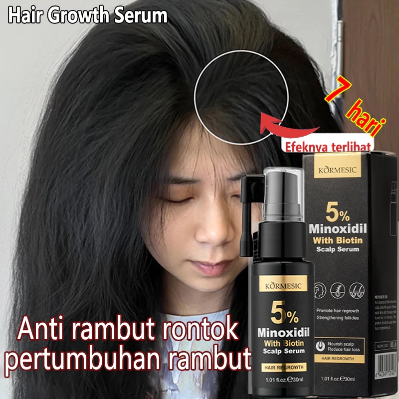 Jual Penumbuh rambut cepat 30ml Minoxidil Serum untuk Rambut Rontok dan ...