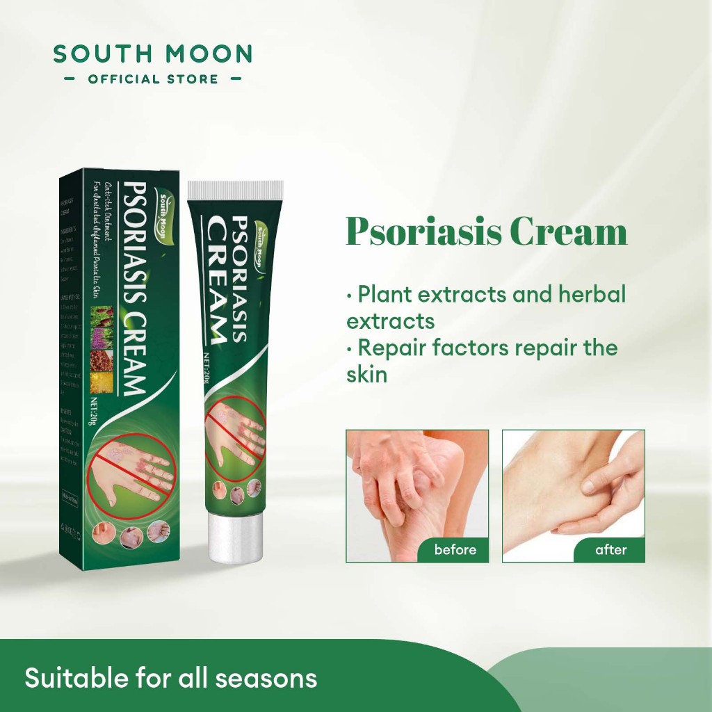 Jual South Moon Salep Psoriasis Eksim 20g Obat Gatal Kulit Paling Ampuh ...