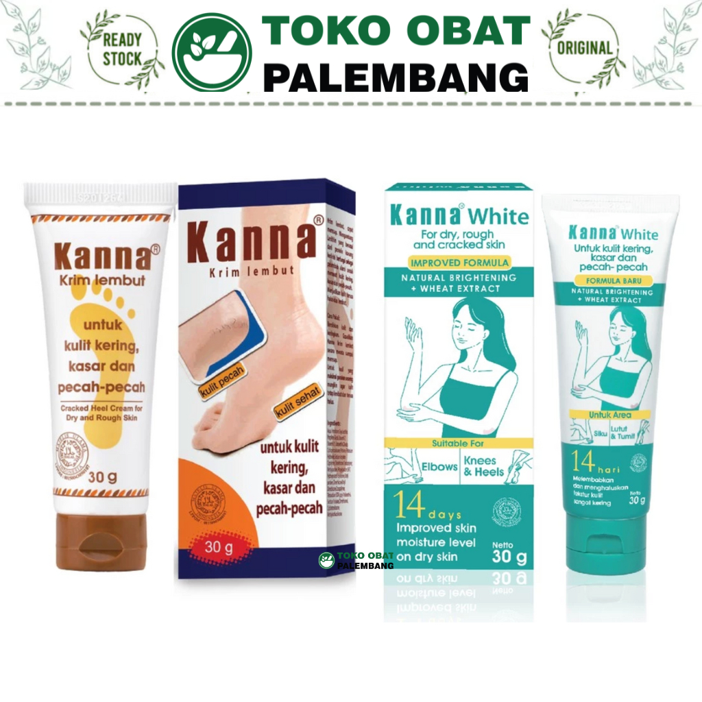 Jual KANNA KRIM LEMBUT 30GRAM KANNA WHITE ULIT KERING KASAR PECAH SOFT ...