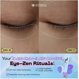 Jual EMINA GLO RAD+ EYE WAKE UP ROLLER 15ML | Shopee Indonesia