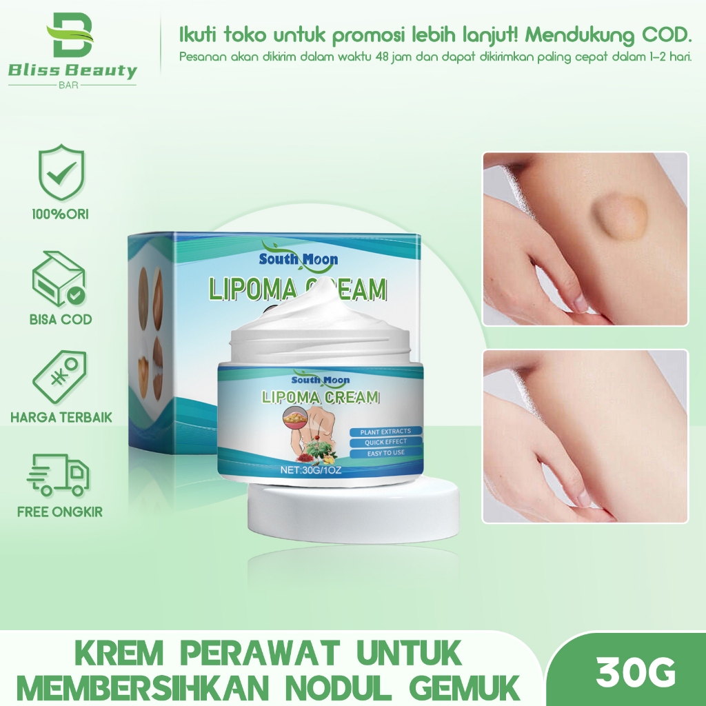 Jual South Moon Lipoma Removal Cream 30g Lipoma Cream Obat Benjolan ...