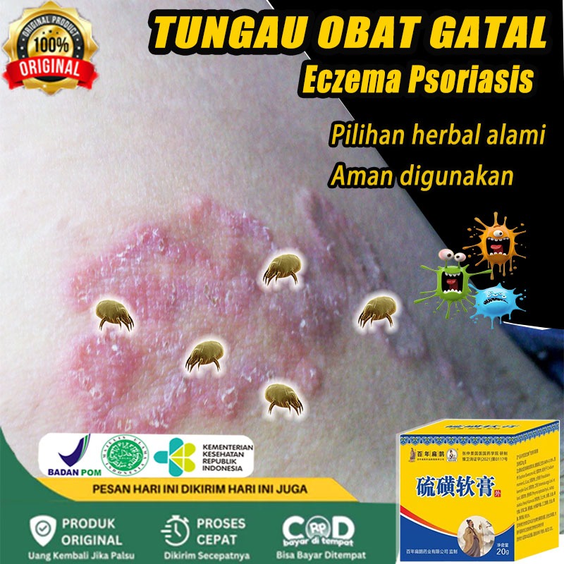 Jual Obat gatal Obat tungau Obat eksim Obat psoriasis 20g Salep gatal ...