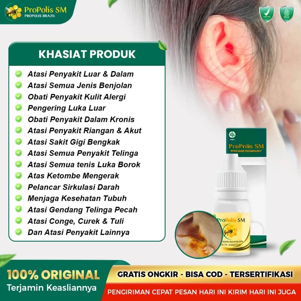 Jual Obat Tetes ProPolis SM Khasiat Perontok Kutil Kelamin, Kutil ...