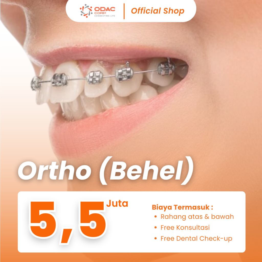 Jual Paket Behel Metal Basic Komplit: Rahang Atas dan Bawah, Basic ...