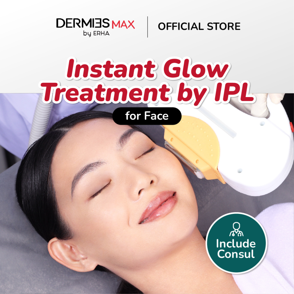 Jual Dermies Max Instant Glow Treatment by IPL (Face) | Shopee Indonesia