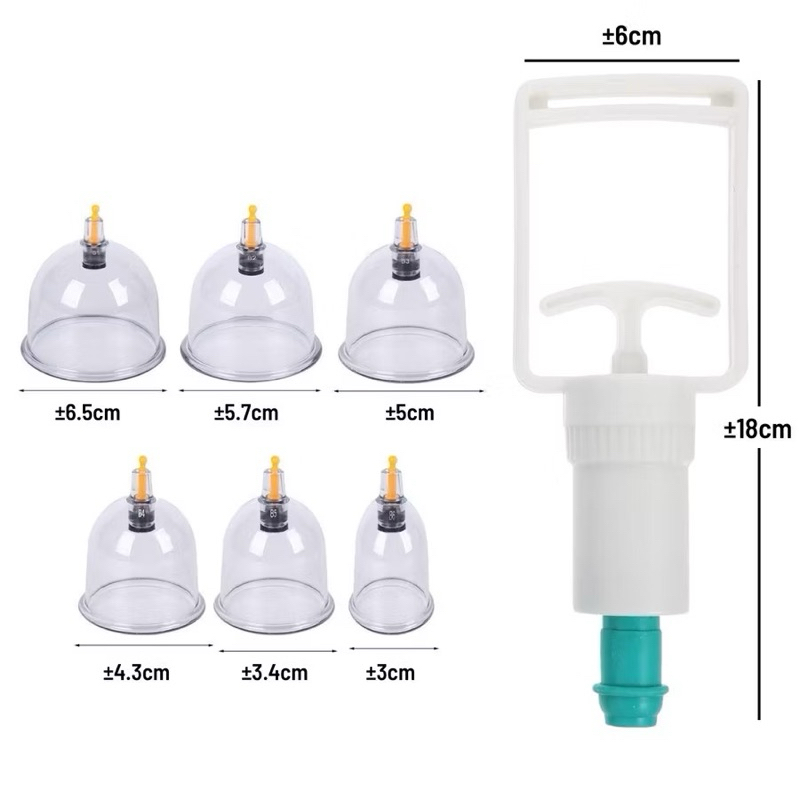 Jual Kop Angin Alat Bekam Isi 6 Cup Mengobati Masuk Angin dan Kesehatan | Shopee Indonesia