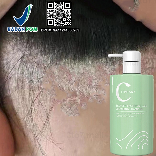 Jual BPOM ketomed shampoo sampo anti gatal and ketombe shampoo ...