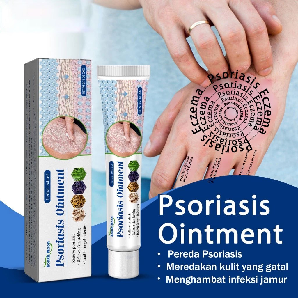 Jual Psoriasis ointment 20g Kegatalan kulit Salep eksim Salep Herbal ...