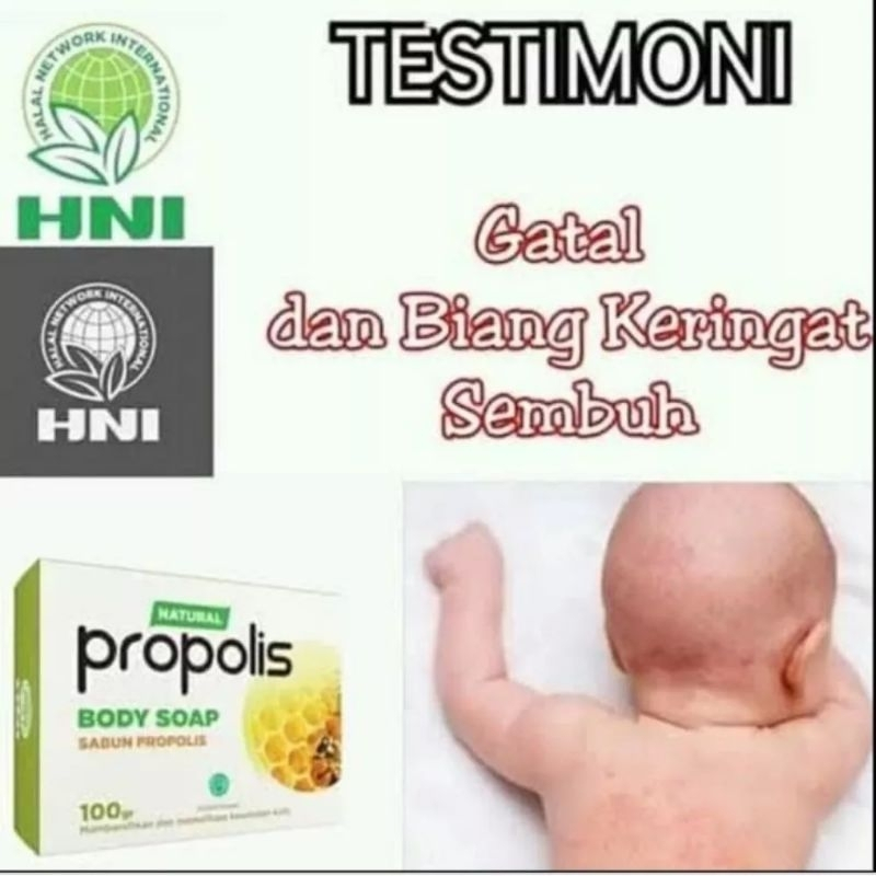 Jual HNI Sabun Mandi Propolis HNI 100 Gram | Shopee Indonesia