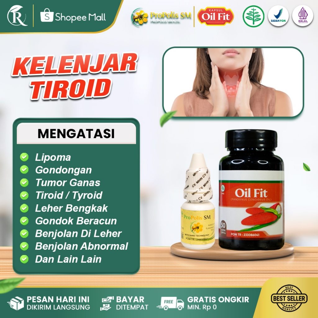 Jual Obat Benjolan Tiroid / Tyroid, Gondok, Kelenjar Getah Bening ...