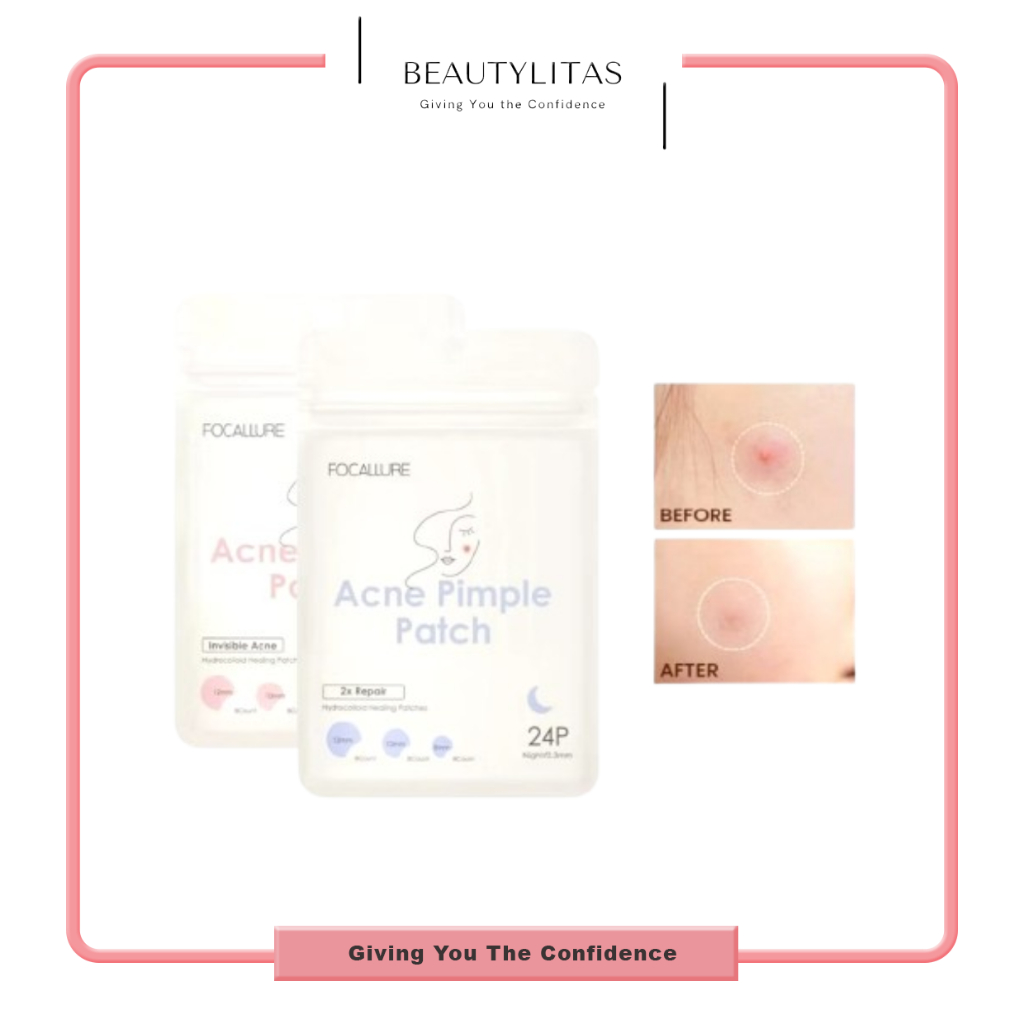Jual FOCALLURE Acne Pimple Spot Patch Acne Treatment | Shopee Indonesia