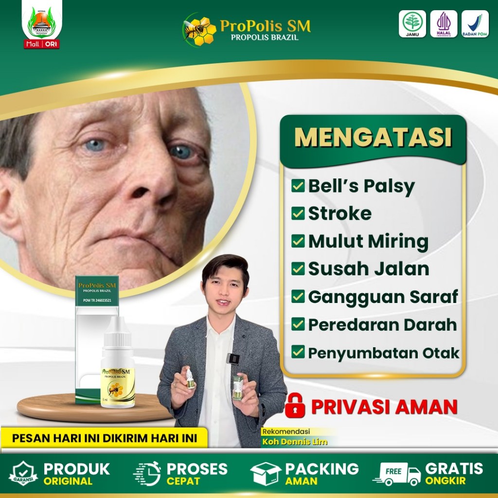Jual Obat Bells Palsy Stroke Ringan Mulut Miring Susah Jalan ...