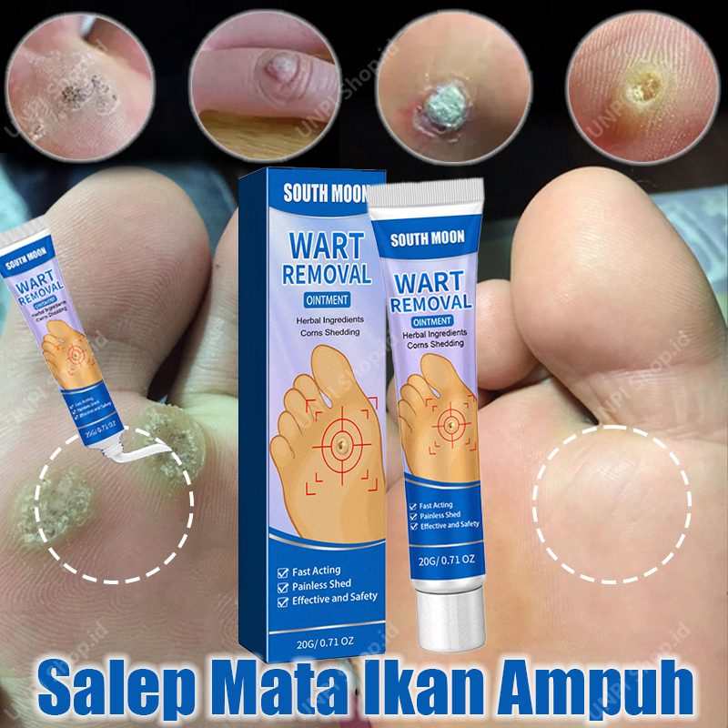 Jual Salep Mata Ikan Telapak Kaki Obat Mata Ikan Kaki Penghilang Mata ...