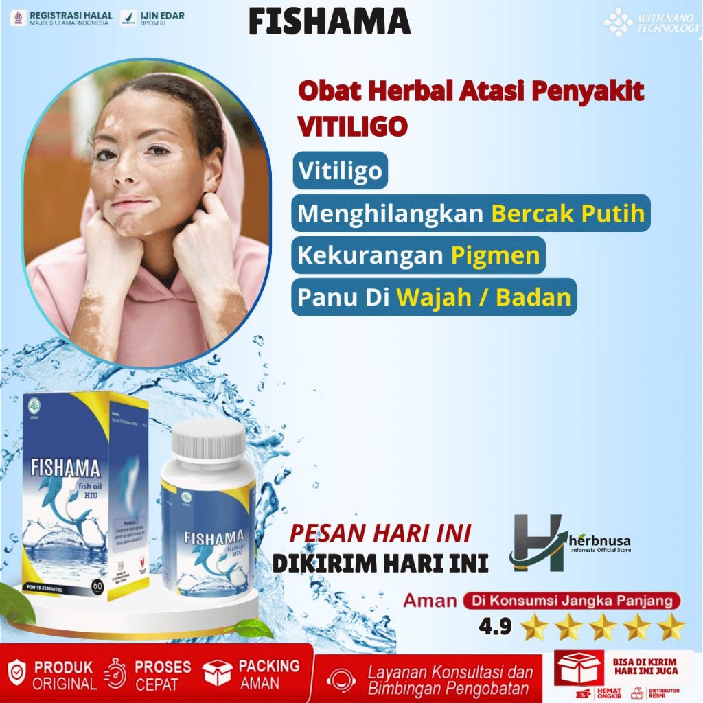 Jual Obat Vitiligo Penghilang Vitiligo Kulit Bercak Putih Belang ...