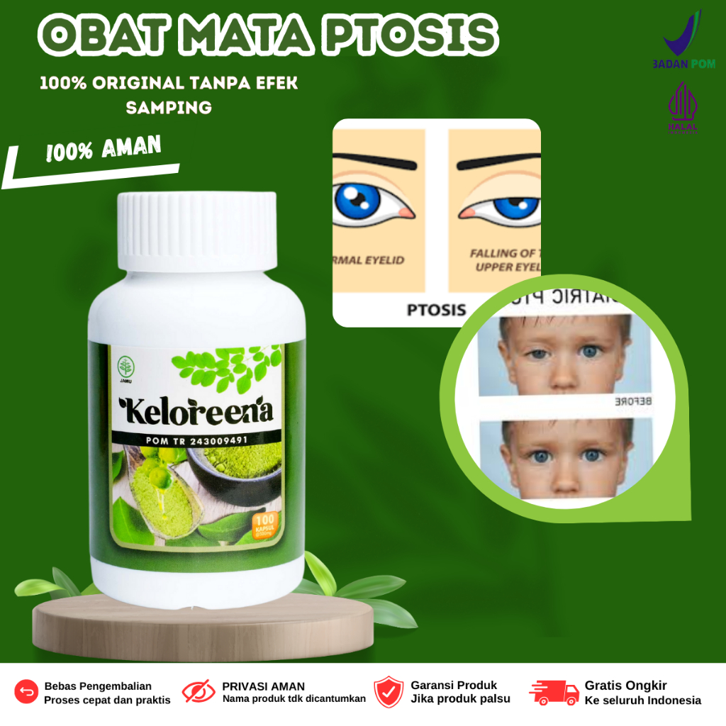 Jual Obat Mata Ptosis Lipatan Kelopak Mata Kendur sipit syaraf mata ...