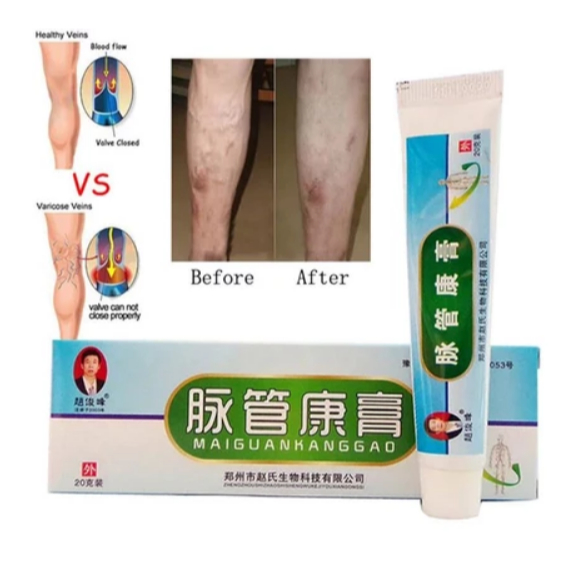 Jual ORIGINAL SALEP OBAT KAKI VARISES PALING AMPUH ORIGINAL DAN PEGAL ...