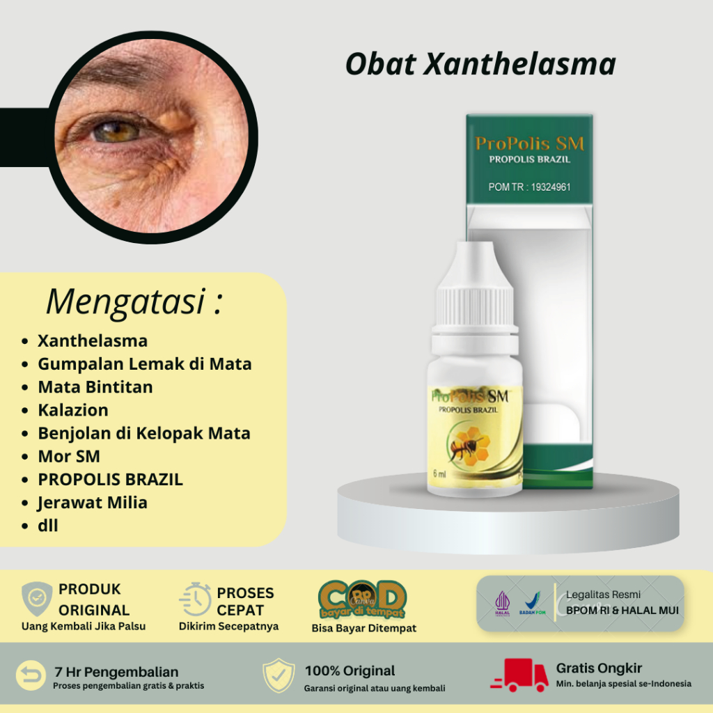 Jual Obat Xanthelasma, Gumpalan Lemak Di Kelopak Mata, Obat Penghilang ...