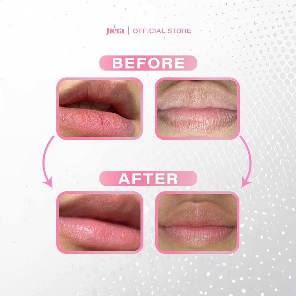 Jual JIERA Colla C Lip Infusion 10g dengan Vitamin C serta Collagen, Melembapkan bibir ...
