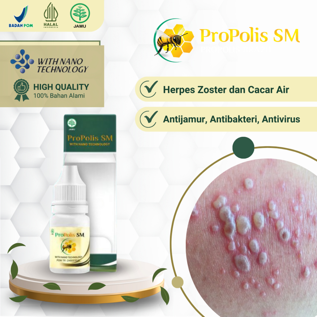 Jual Obat Herpes Zoster, Obat Herpes Kulit, Obat Ruam Hespes, Obat ...