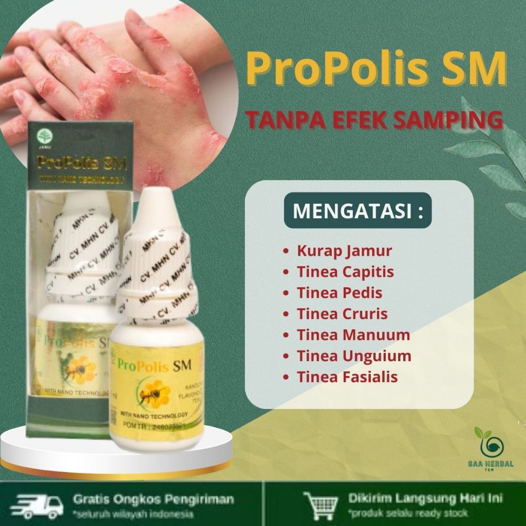 Jual ProPolis SM - Obat Kurap Jamur, Tinea Capitis, Tinea Pedis, Tinea ...