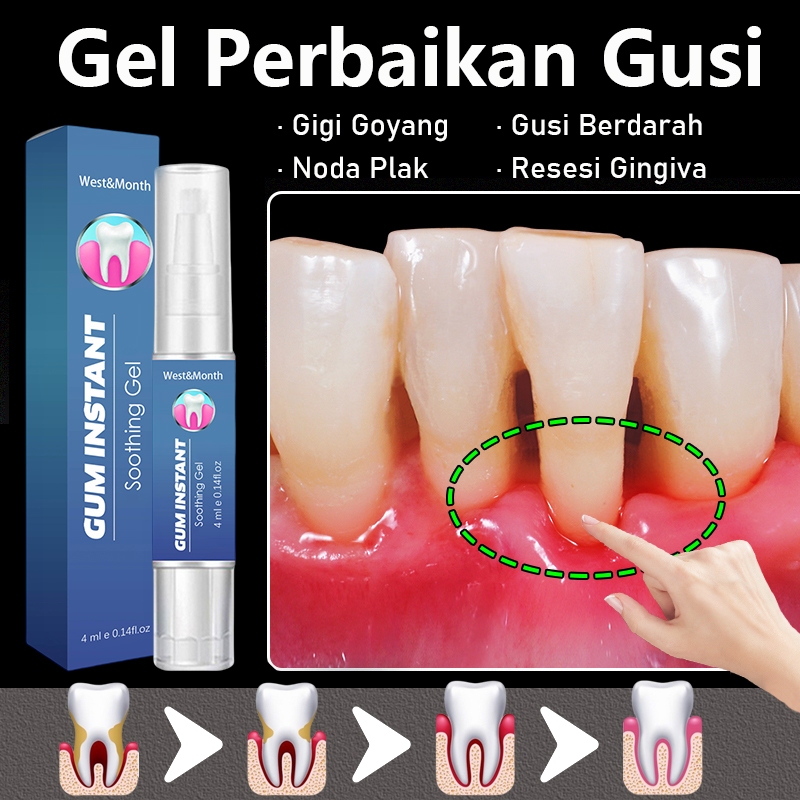 Jual Gel perawatan gusi gum instant untuk gigi gum care Gel Penguat ...