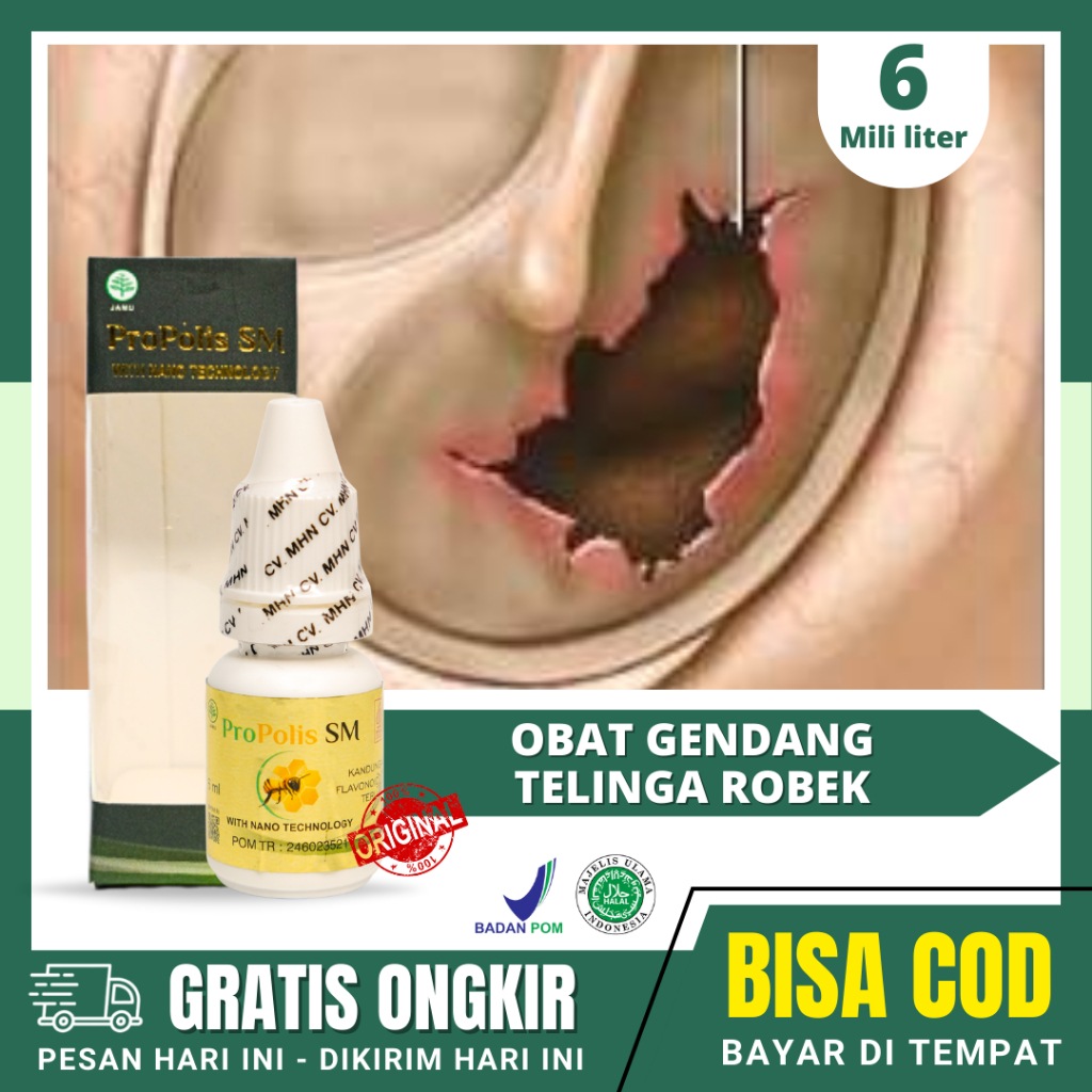 Jual Obat Gendang Telinga Robek, Gendang Telinga Pecah, Bolong, Bernanah Bau Nyeri, Propolis SM ...