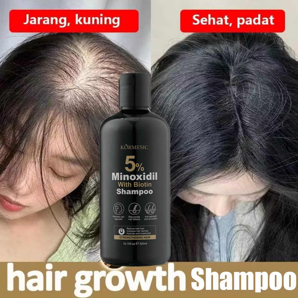 Jual Shampo Penumbuh Rambut Cepat 5% Minoxidil Shampoo 300ml pertumbuhan rambut Pengendalian ...
