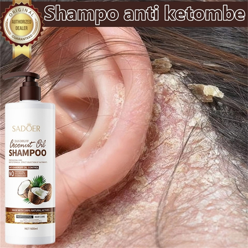 Jual Shampo anti ketombe Coconut shampo Sampo anti gatal dan antiketombe Sampo ketombe parah ...