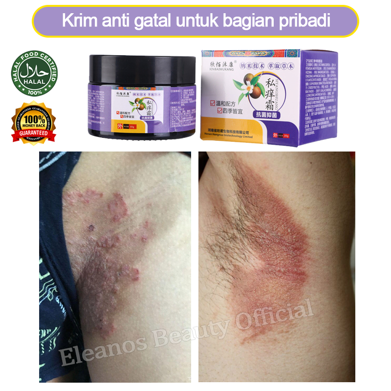 Jual Obat gatal kulit obat alergi gatal kulit salap gatal selangkanga ...