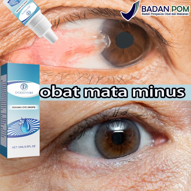 Jual Obat mata minus obat tetes mata Obat mata katarak Tetes mata ...
