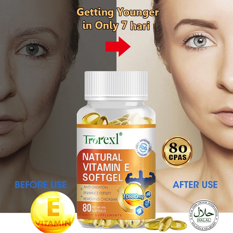 Jual Trorexl Asli Otentik Halal 80 Kapsul Suplemen Vitamin E Alami ...