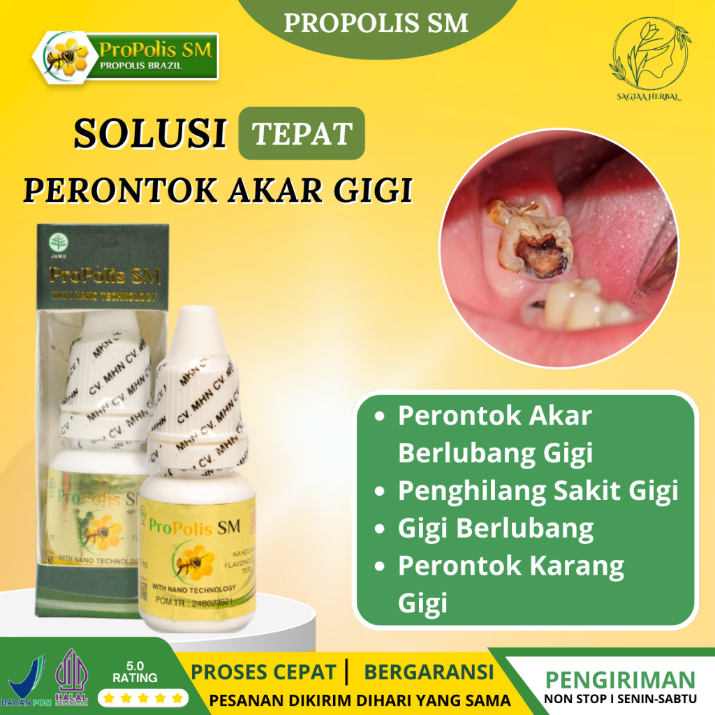 Jual Obat Perontok Akar Berlubang,Gigi Penghilang Sakit Gigi,Gigi ...